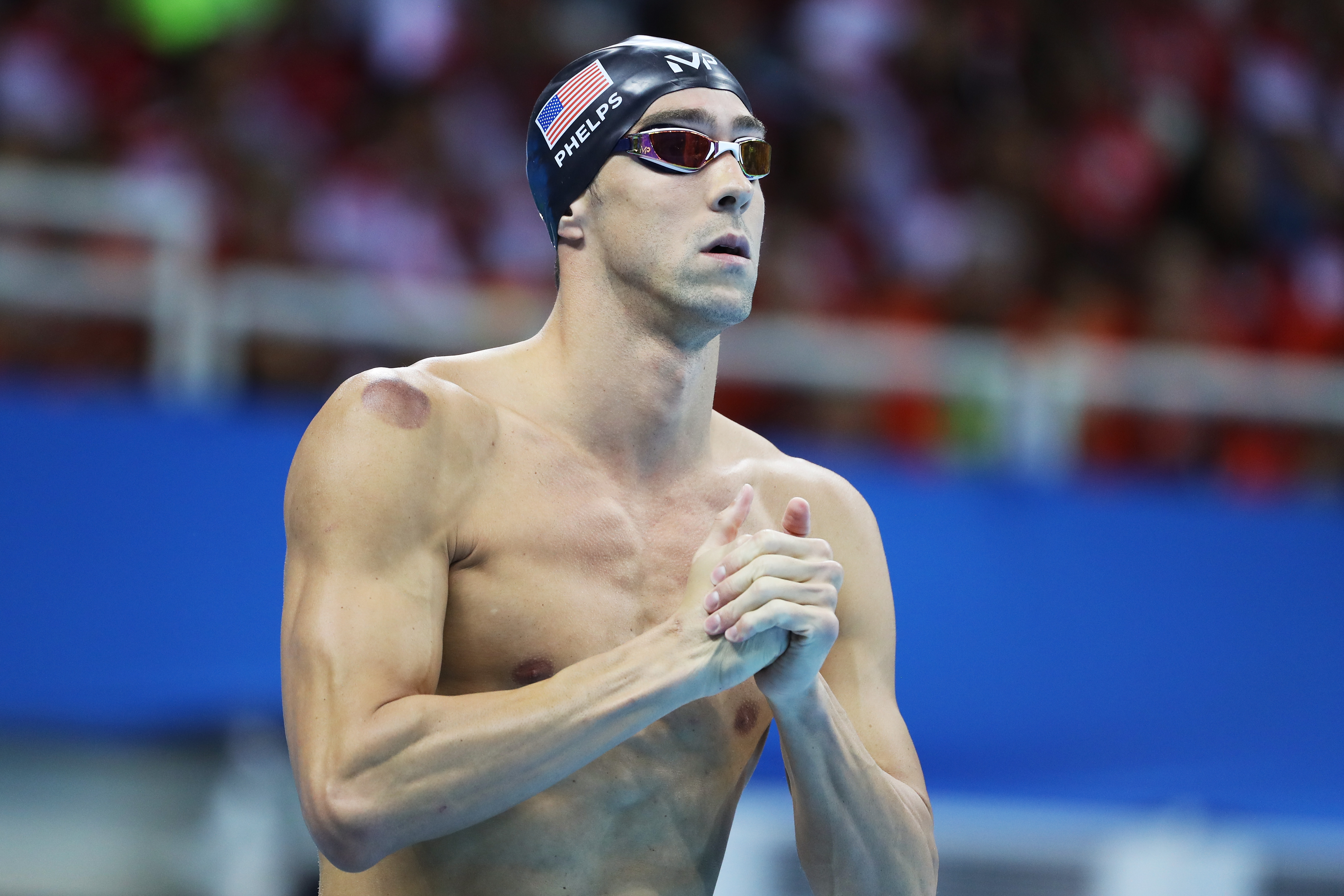 Michael Phelps' Cupping Therapy Strategy Might Have Benefits — But It ...
